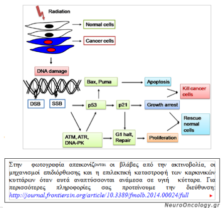 ΑΚΤΙΝΟΘΕΡΑΠΕΙΑ ΠΡΩΤΟΝΙΩΝ | Hellenic NeuroOncology Society
